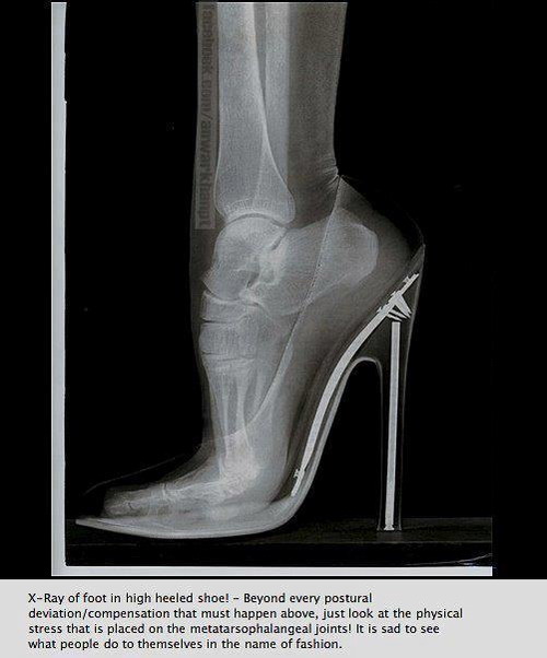 High Heels - The Inside Story | Hilary King, MSTAT